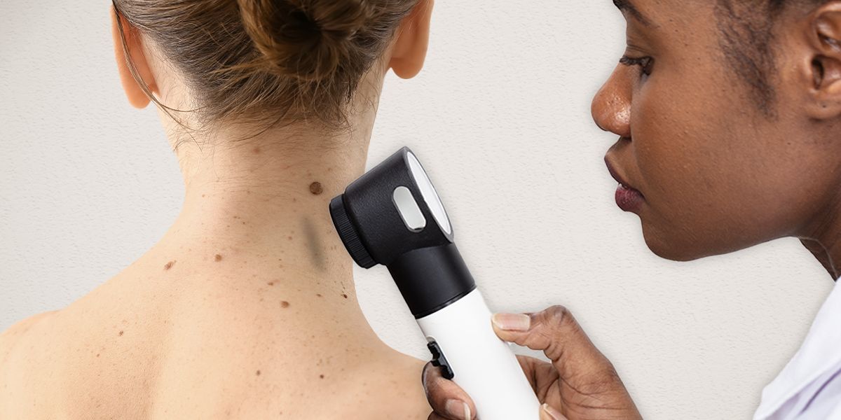 #1 Diagnosed Skin Cancer: What to Look For - The Women's Journal