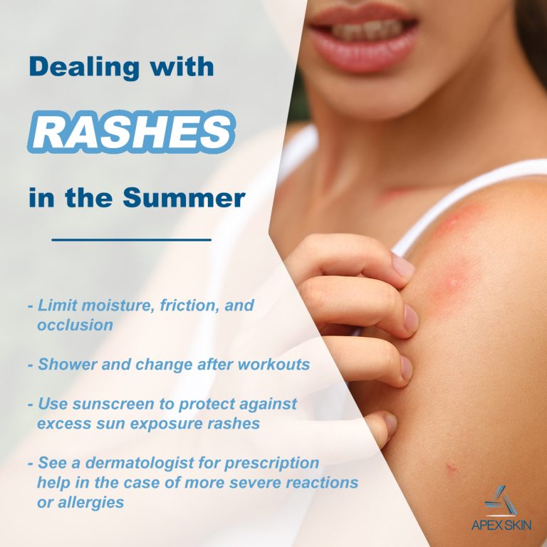 Common Skin Issues in the Summer: Why They Happen & How to Deal - The ...